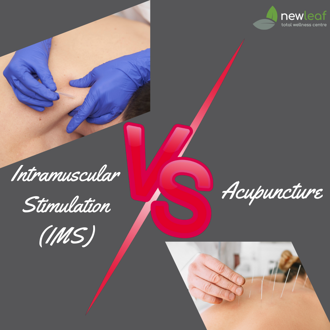 How to Know the Difference Between IMS and Acupuncture. - Newleaf Total Wellness Centre ...